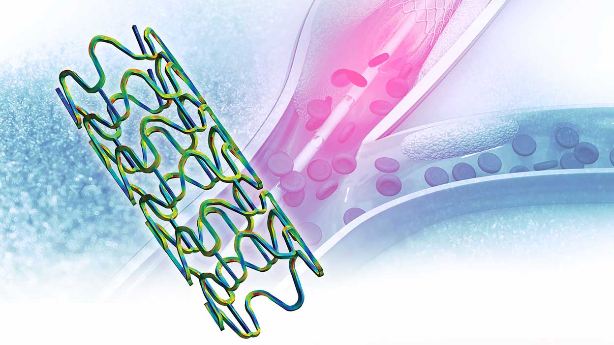 Powerful Design Exploration and Optimization Software | Altair HyperStudy